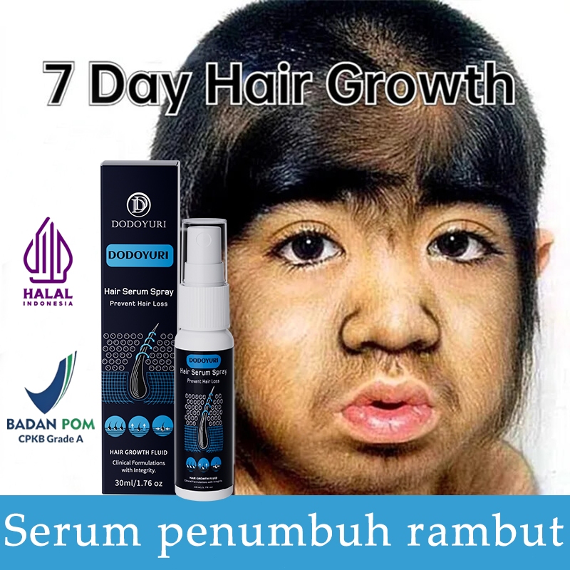 Jual Minoxidil penumbuh rambut serum penumbuh rambut obat rambut rontok ...