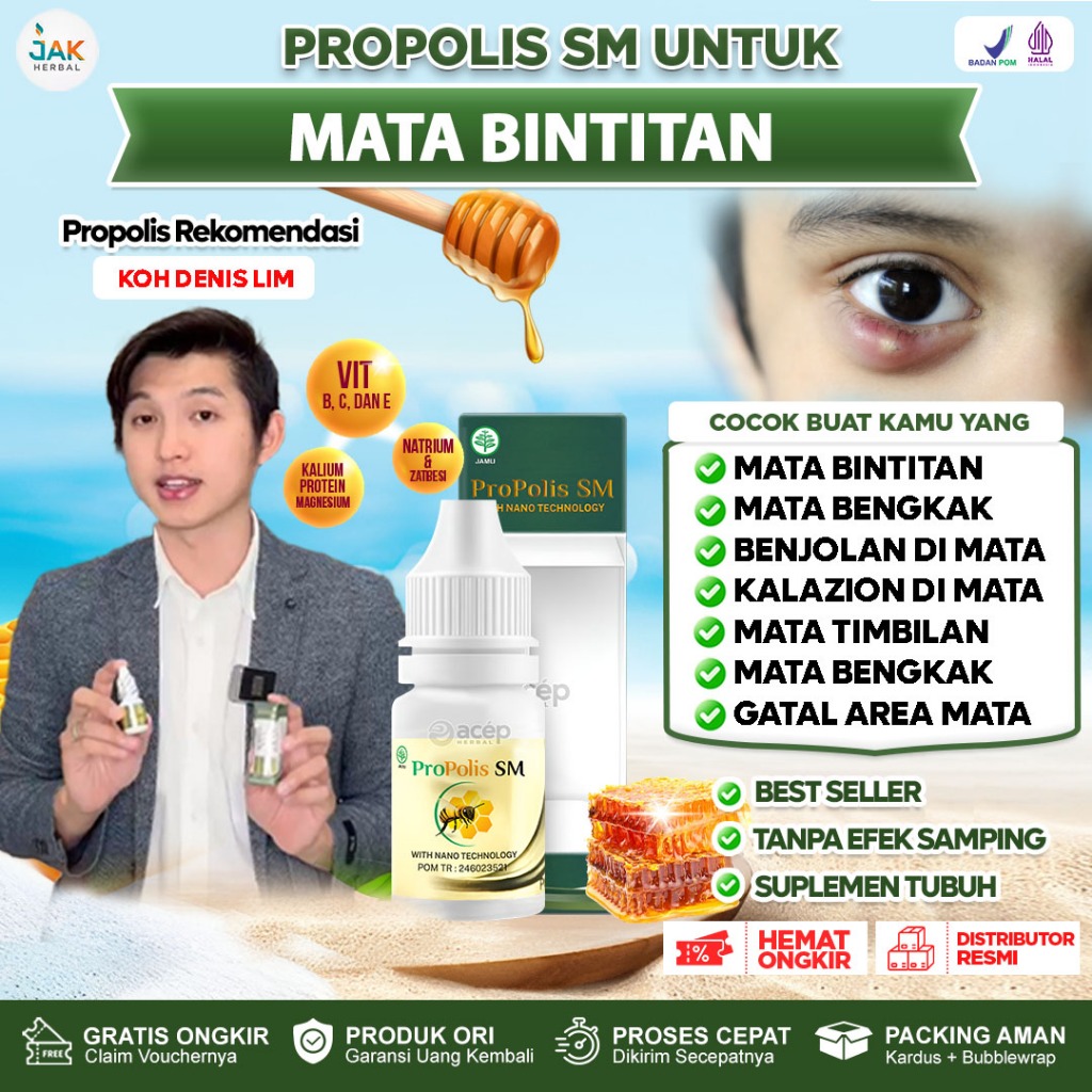 Jual Obat Mata Bintitan Benjolan Di Kelopak Mata Kalazion Timbilan Mata ...