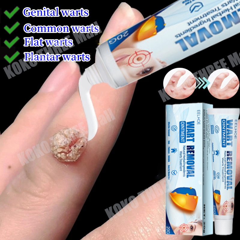 Jual Salep Obat Kutil Paling Wart Removal Cream Penghilang Tahi Lalat ...