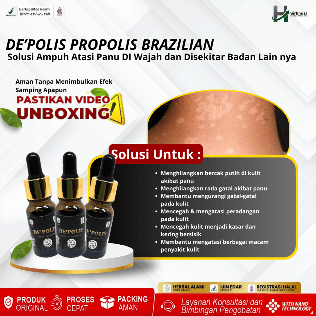 Jual Obat Panu Cair, Obat Panu Anak Dan Dewasa, Obat Penghilang Panu ...