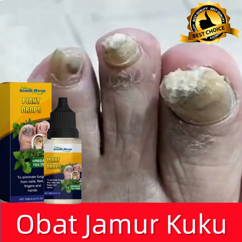 Jual Obat Jamur Kuku Obat Kuku Rusak Serum Kuku Jamur Dan Rusak Obat ...