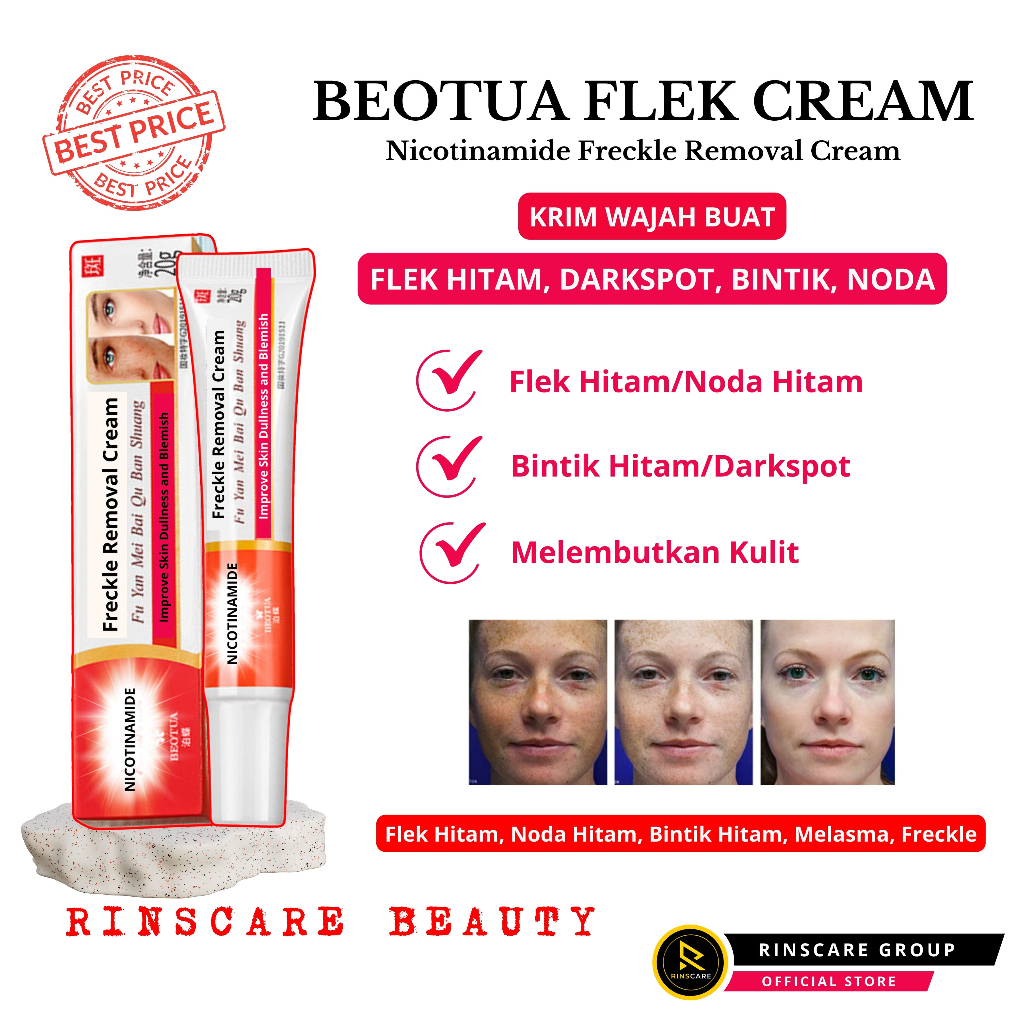 Jual [ DARK SPOT CREAM ] Beotua Nicotinamide Freckle Cream Improve Skin ...