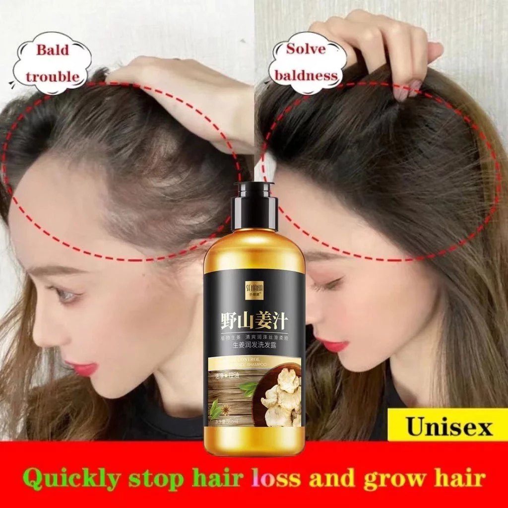 Jual 300ml Shampo Penumbuh Rambut Cepat Ginger Shampoo pertumbuhan rambut Pengendalian Minyak ...