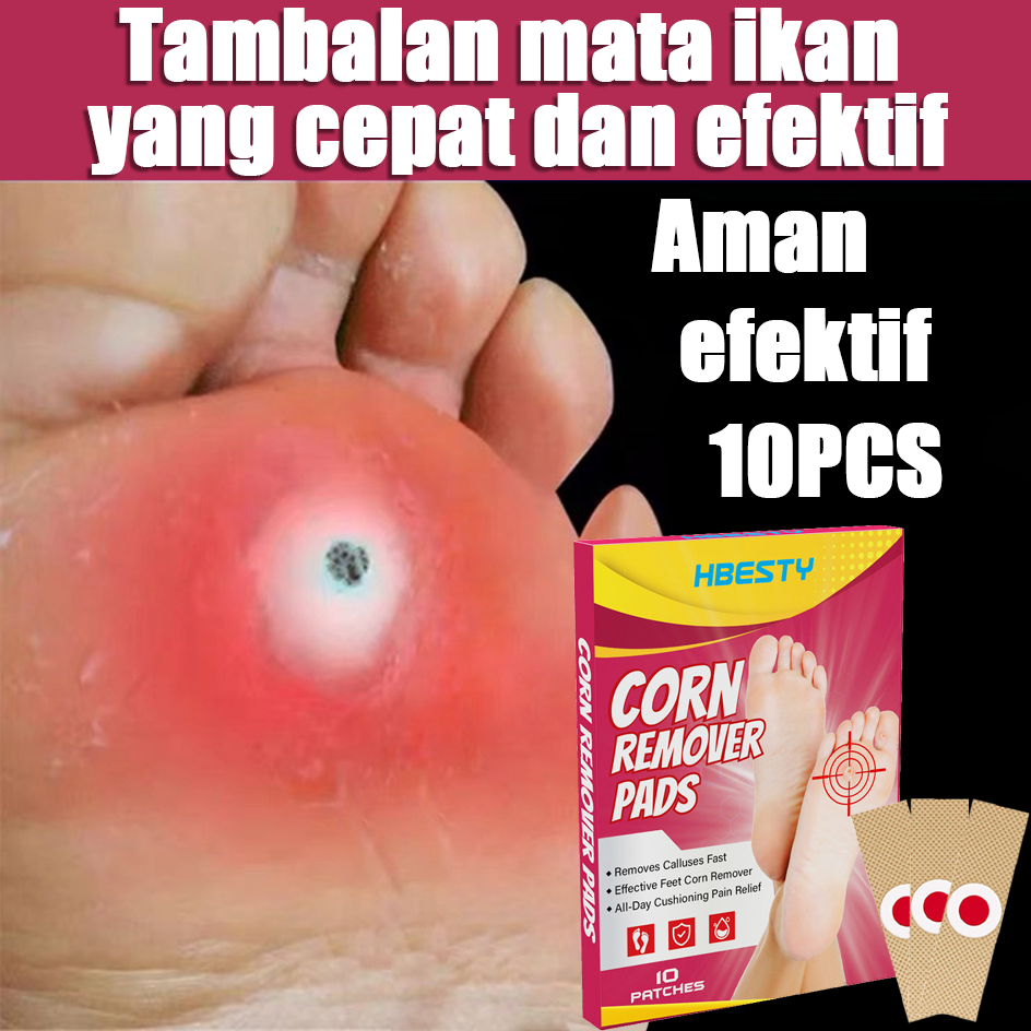 Jual Plester Mata Ikan Paling Ampuh Plester Kutil Dan Mata Ikan Obat ...