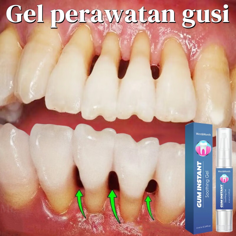 Jual Gel perawatan gusi Gum care gel Perawatan Gusi Mulut Bersih Pen ...