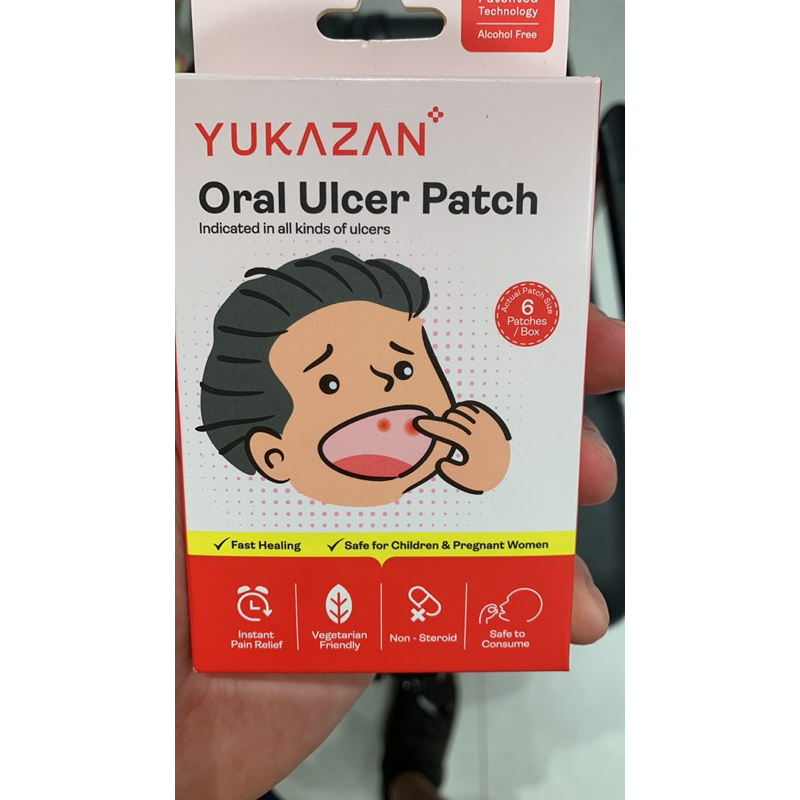 Jual Plester Sariawan Anak / Ibu Hamil Yukazan Oral Ulcer Patch ...