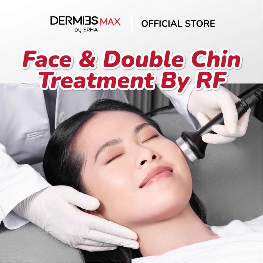 Jual Dermies Max Face & Double Chin Lifting Treatment by RF | Shopee ...