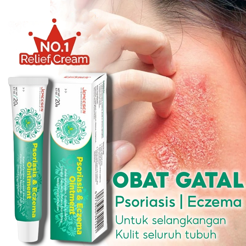 Jual Jemeesen Obat Gatal Salep Psoriasis Eczema Cream Paling Ampuh ...