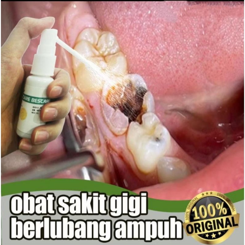 Jual BESCARE Spray Sakit gigi Berlubang Ampuh Obat Sakit gigi Paling Ampuh Obat Sakit Gigi ...