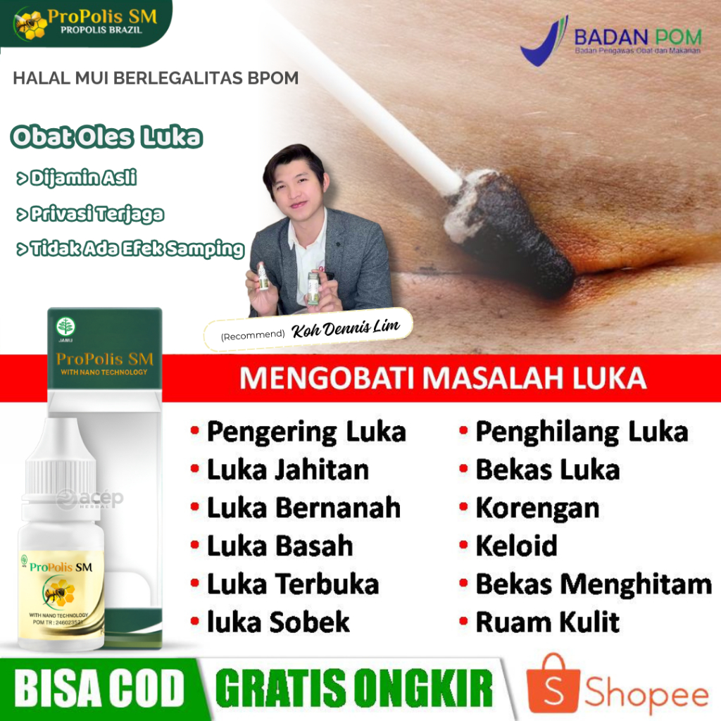 Jual Obat Pengering Luka Jahitan, Bekas Operasi Sesar, Penghilang Luka ...