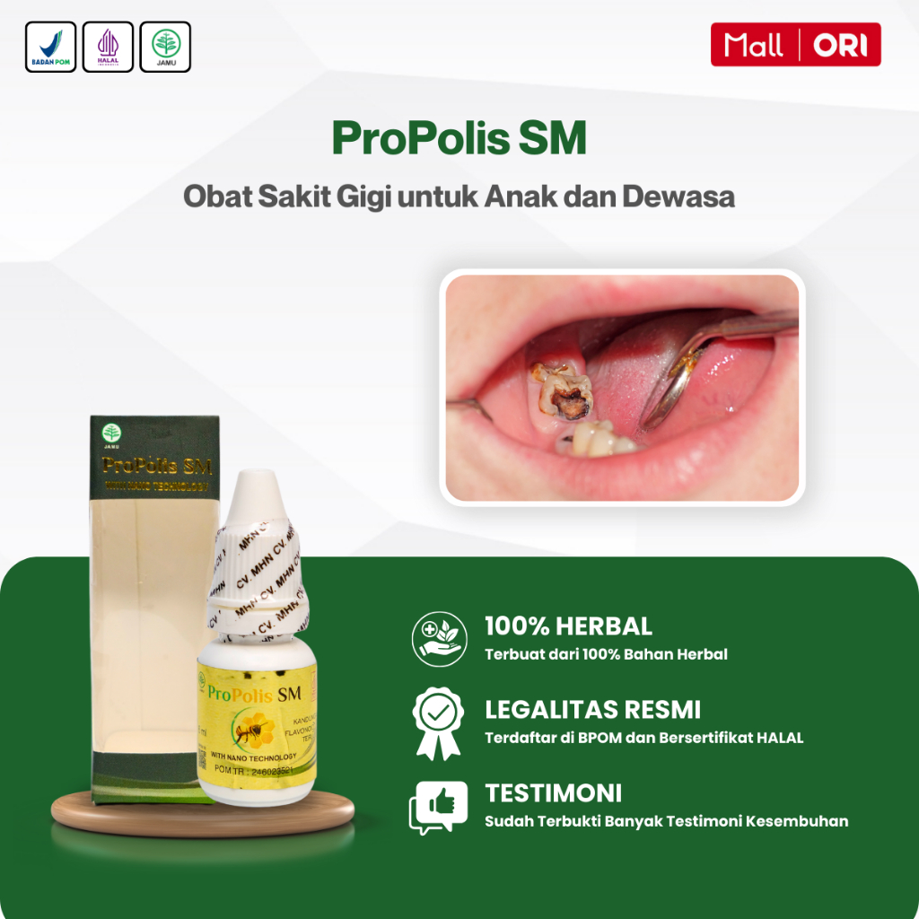 Jual Propolis SM - Obat Tetes / Kumur Sakit Gigi Berlubang Nyeri Gusi ...