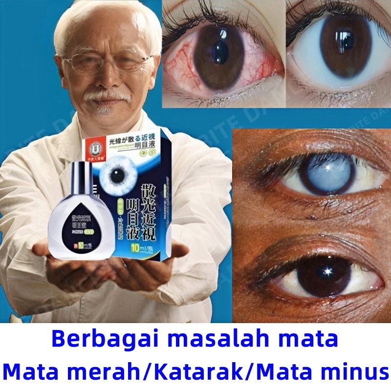 Jual obat mata katarak obat mata minus Pengobatan mata merah mata buram ...
