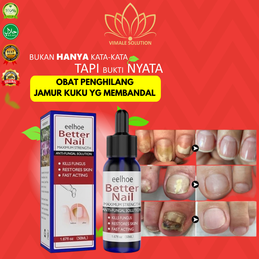 Jual Obat Jamur Kuku Obat kuku jamur dan rusak Nail Repair Essence ...