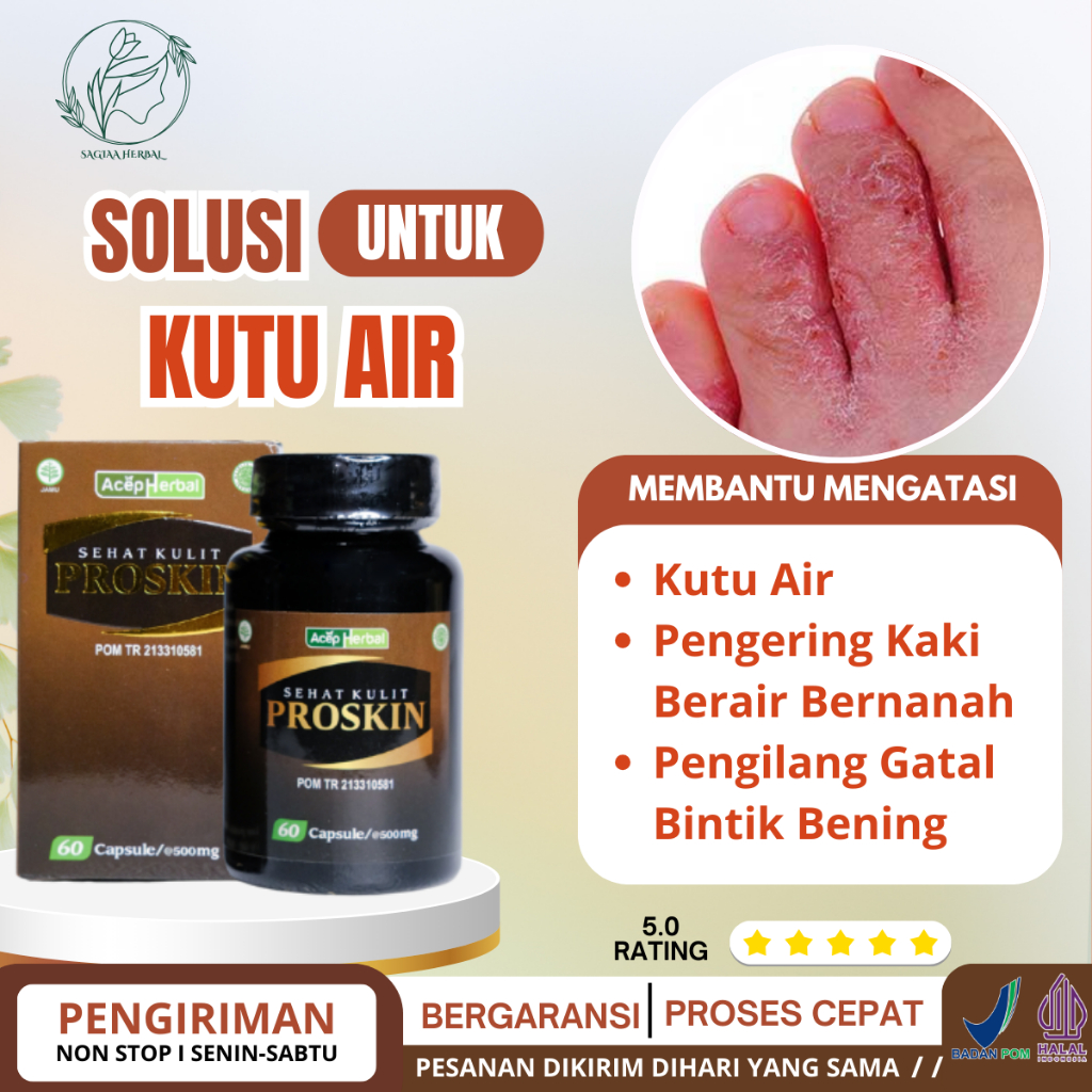 Jual Obat Kutu Air Pengering Kaki Berair Bernanah Pengilang Gatal ...