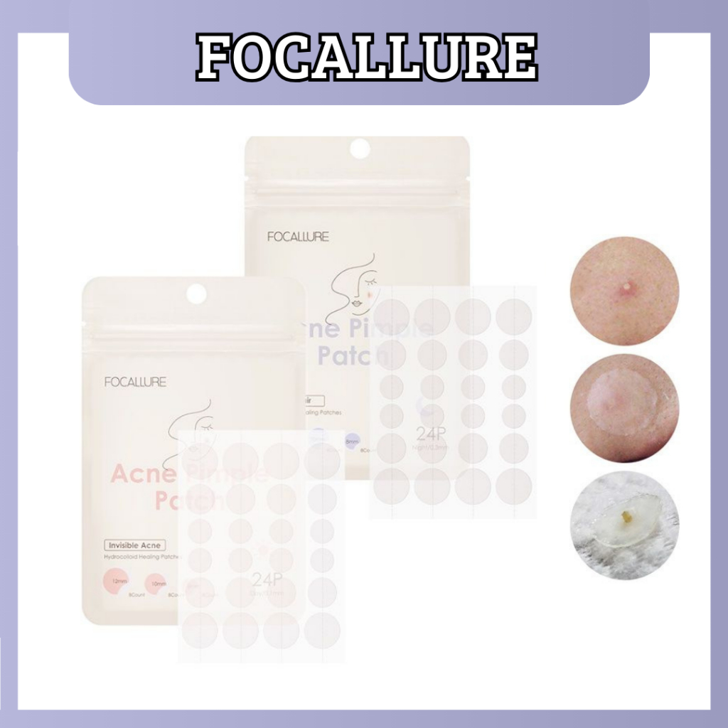 Jual Focallure Spot Acne Patch Treatment Day/Night Waterproof Smooth ...
