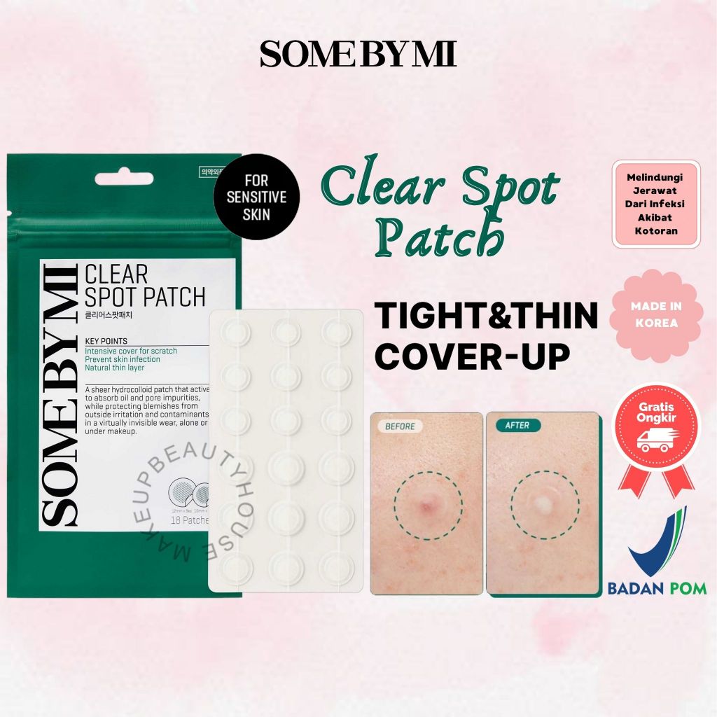Jual SOMEBYMI 30 Days Miracle Clear Spot Patch (18 Patchs) | Shopee ...