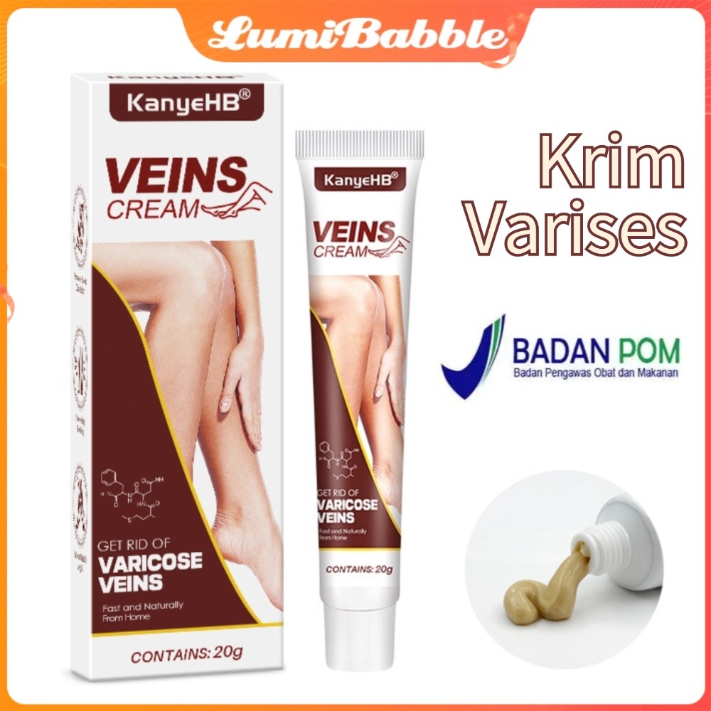 Jual KanyeHB Maikang Cream Varicose Veins Obat Varises Di Kaki Dan ...