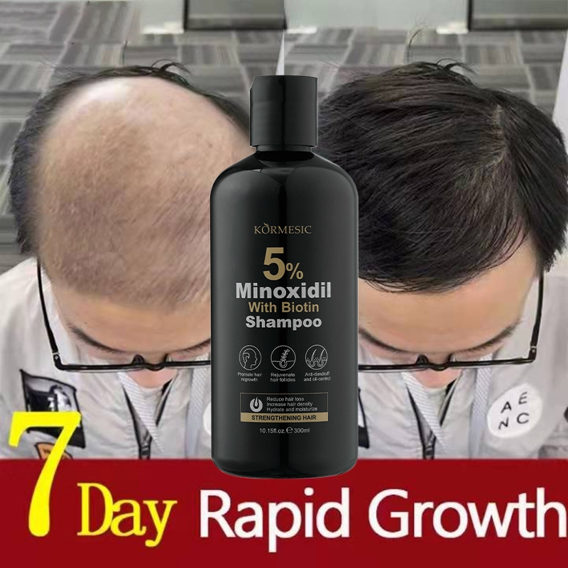 Jual Minoxidil Hair shampoo Hair Fall Treatment Shampoo Shampo Penumbuh ...