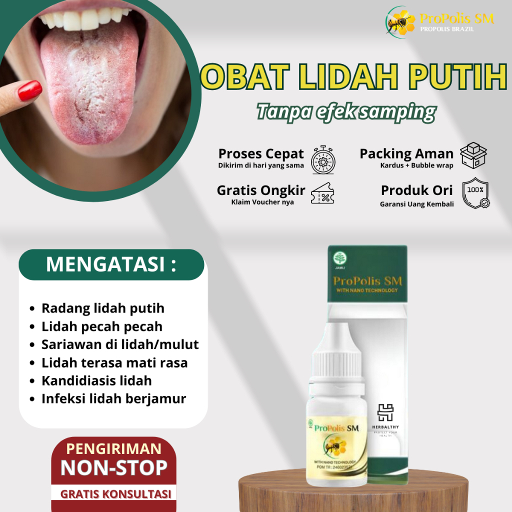 Jual Propolis Sm Obat Lidah Putih Berjamur Kandidiasis Mukokutan ...