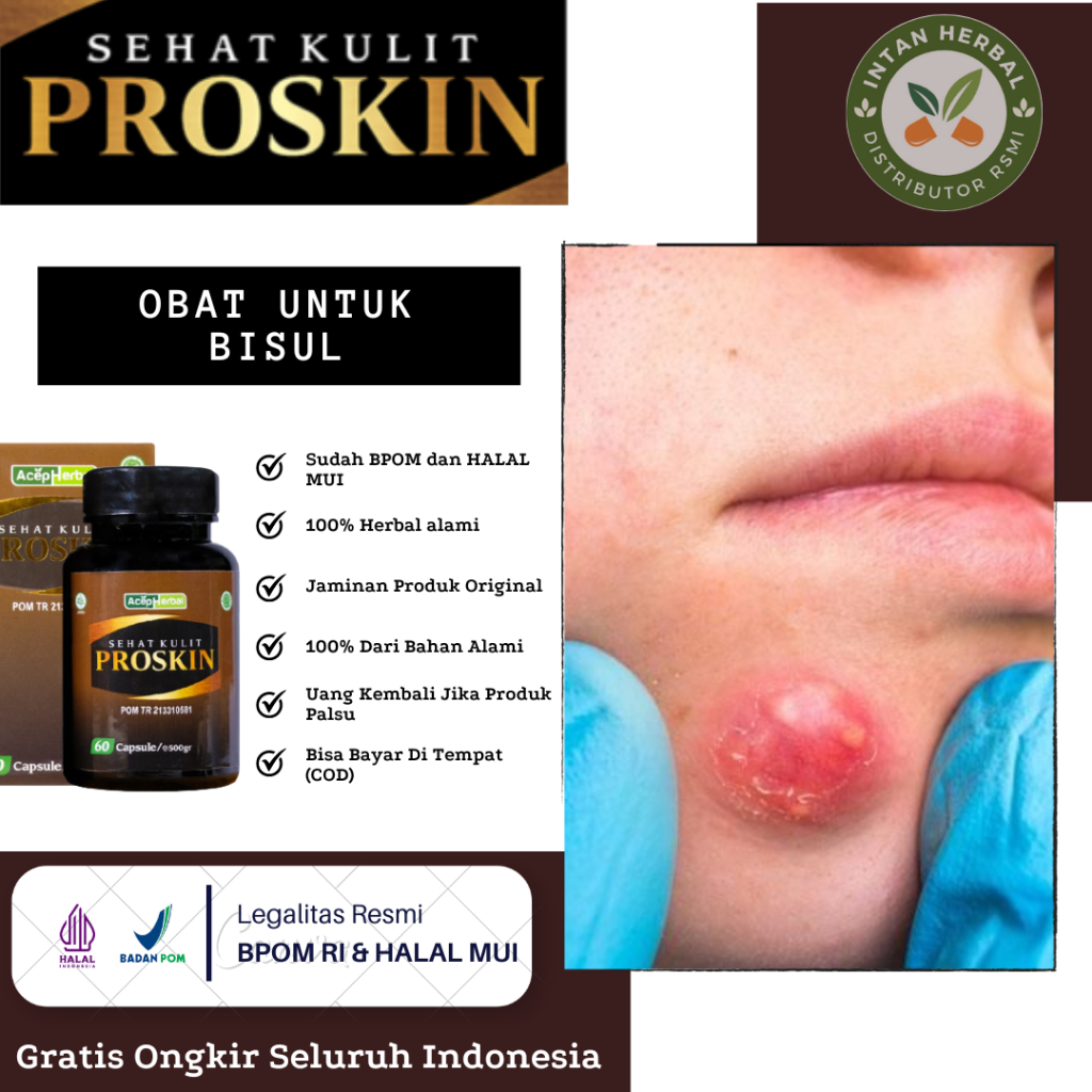 Jual Proskin Kapsul - Obat Atasi Bisul, Bisul di Wajah, Bisul di Pantat ...