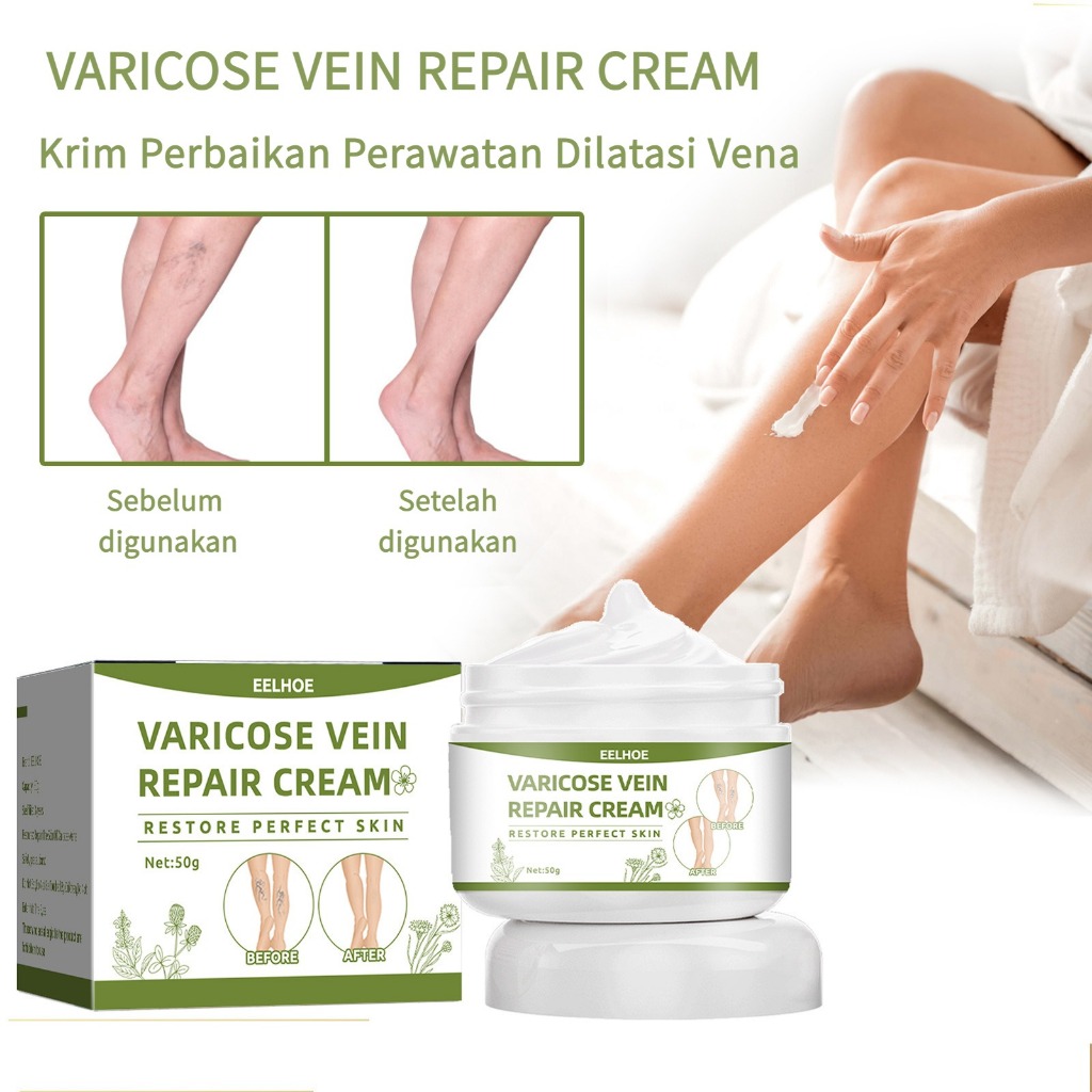Jual Krim Perbaikan Vena Krim Perbaikan Perawatan Varises Krim ...