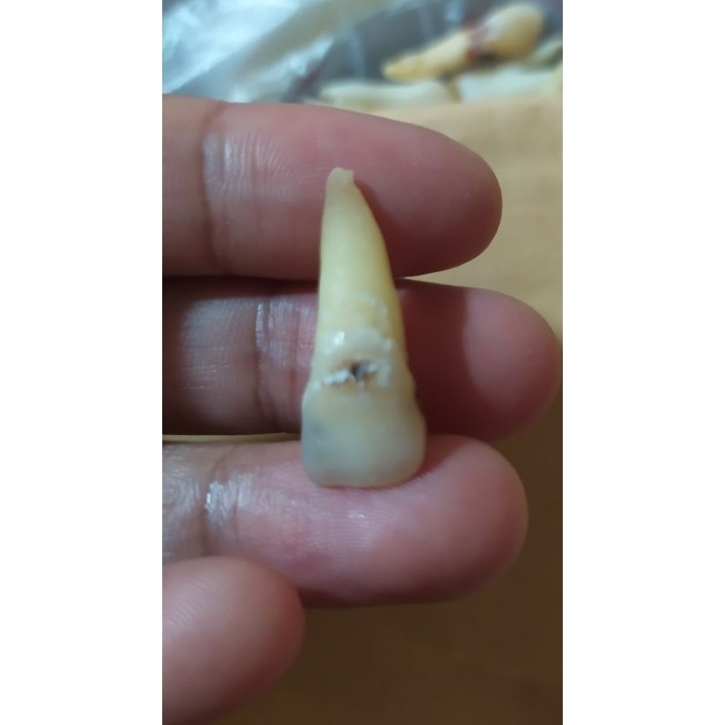 Jual Gigi 21/Gigi insisivus sentral atas/gigi insisivus/gigipraktikum ...