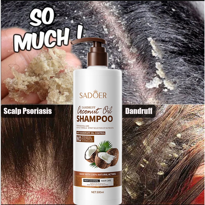 Jual Shampo anti ketombe Coconut shampo Sampo anti gatal dan antiketombe Sampo ketombe parah ...