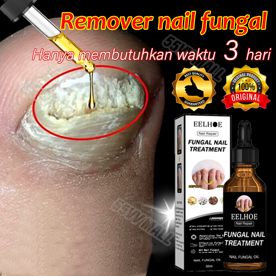 Jual Obat Jamur Kuku serum kuku obat kuku jamur dan rusak vitamin kuku ...
