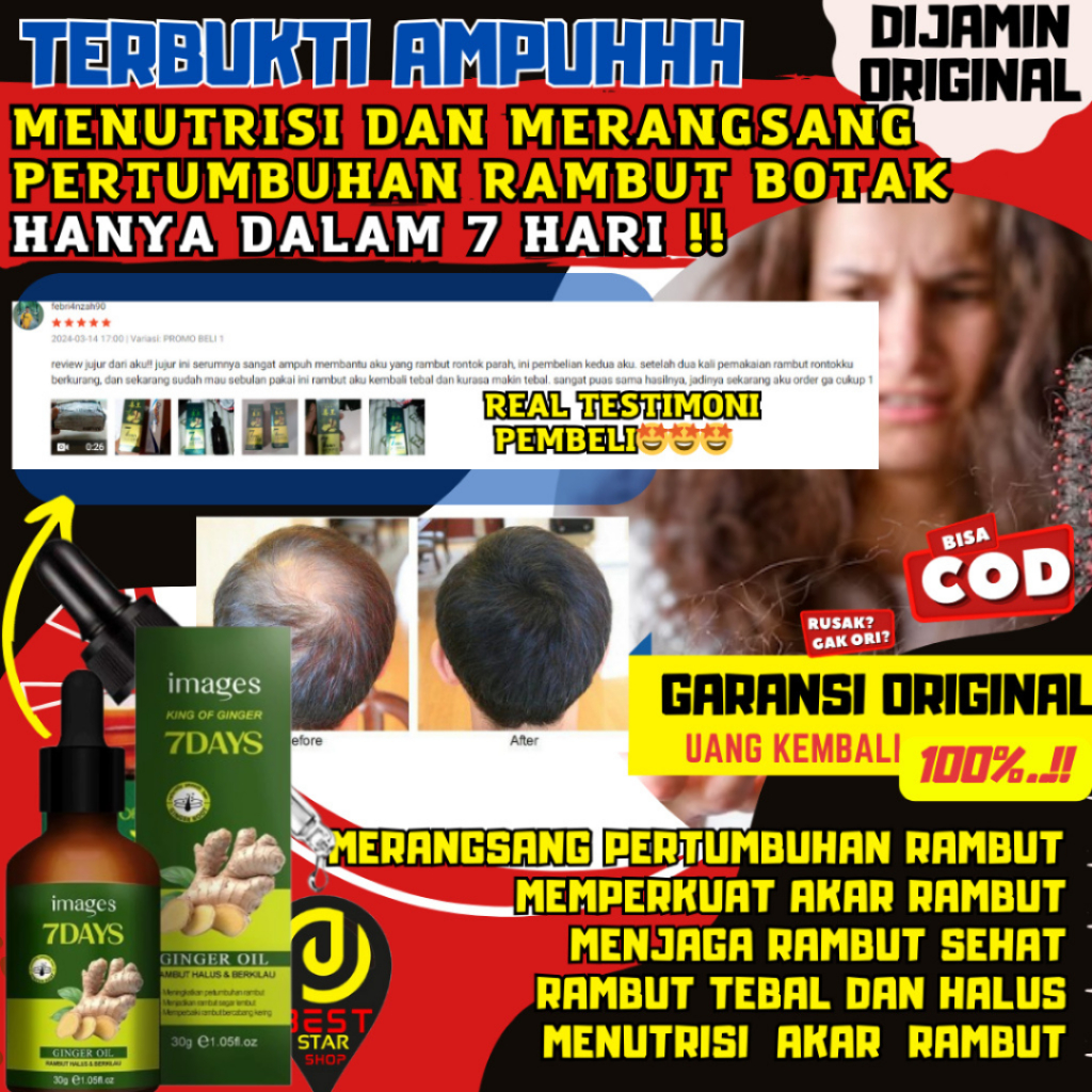 Jual Penumbuh Botak Dan Rontok (HANYA 7 HARI) Pria Anak Bayi Balita ...