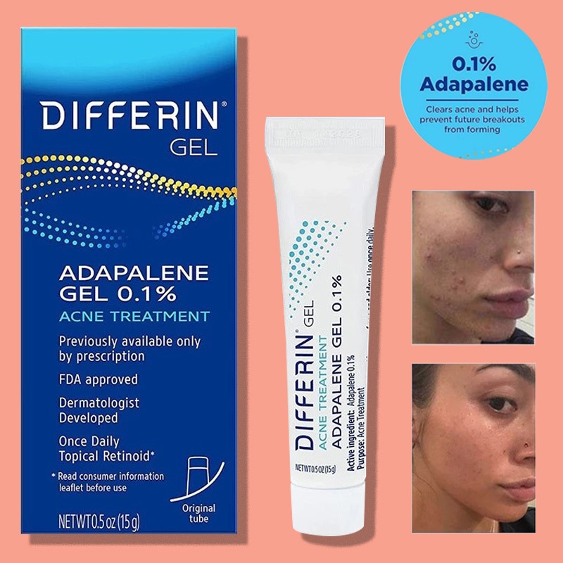 Jual Differin Acne Treatment Gel 15 g USA / Acne Treatment / Adapalene ...