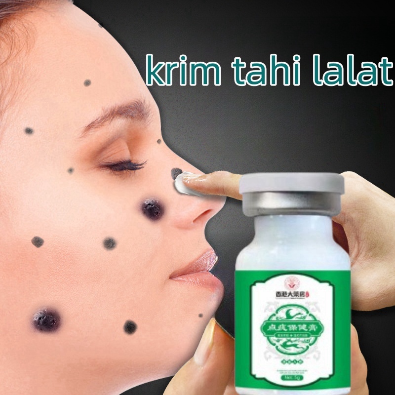 Jual Obat penghilang tahi lalat Skin Tag Remover Salep penghilang tahi ...