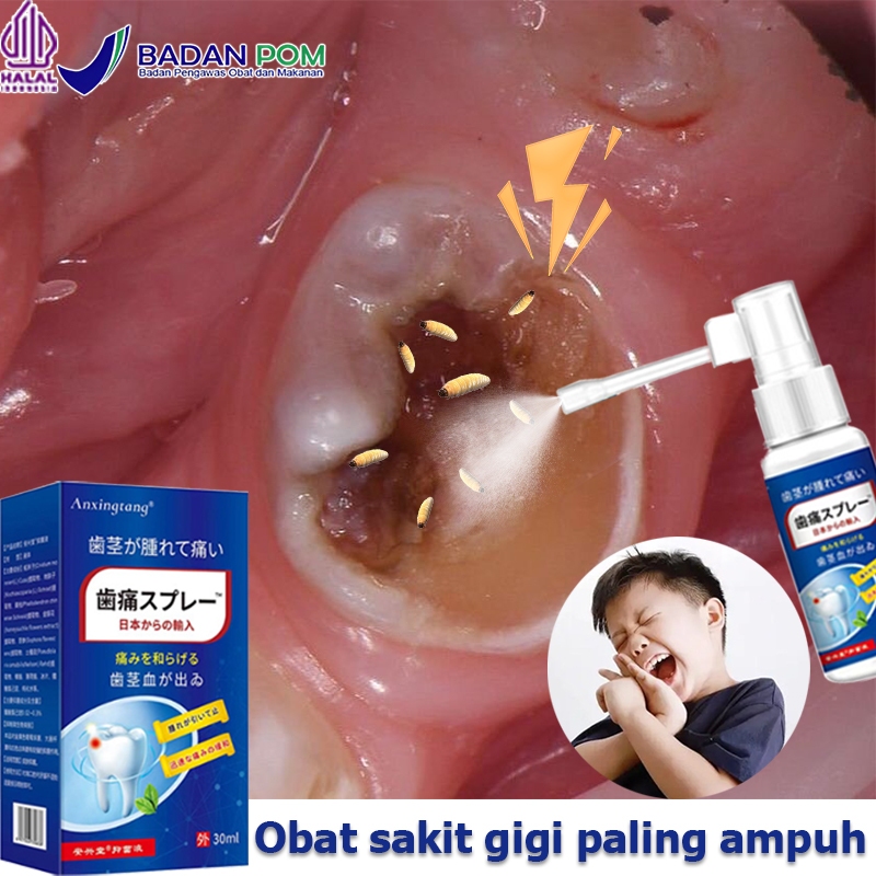 Jual Obat sakit gigi semprot Obat sakit gigi anak Obat sakit gigi berlubang 20ml Obat sakit gigi ...