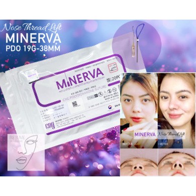 Jual MINERVA PDO Benang Hidung Cuping Thread Lift PDO 19G*38MM//Ecer ...