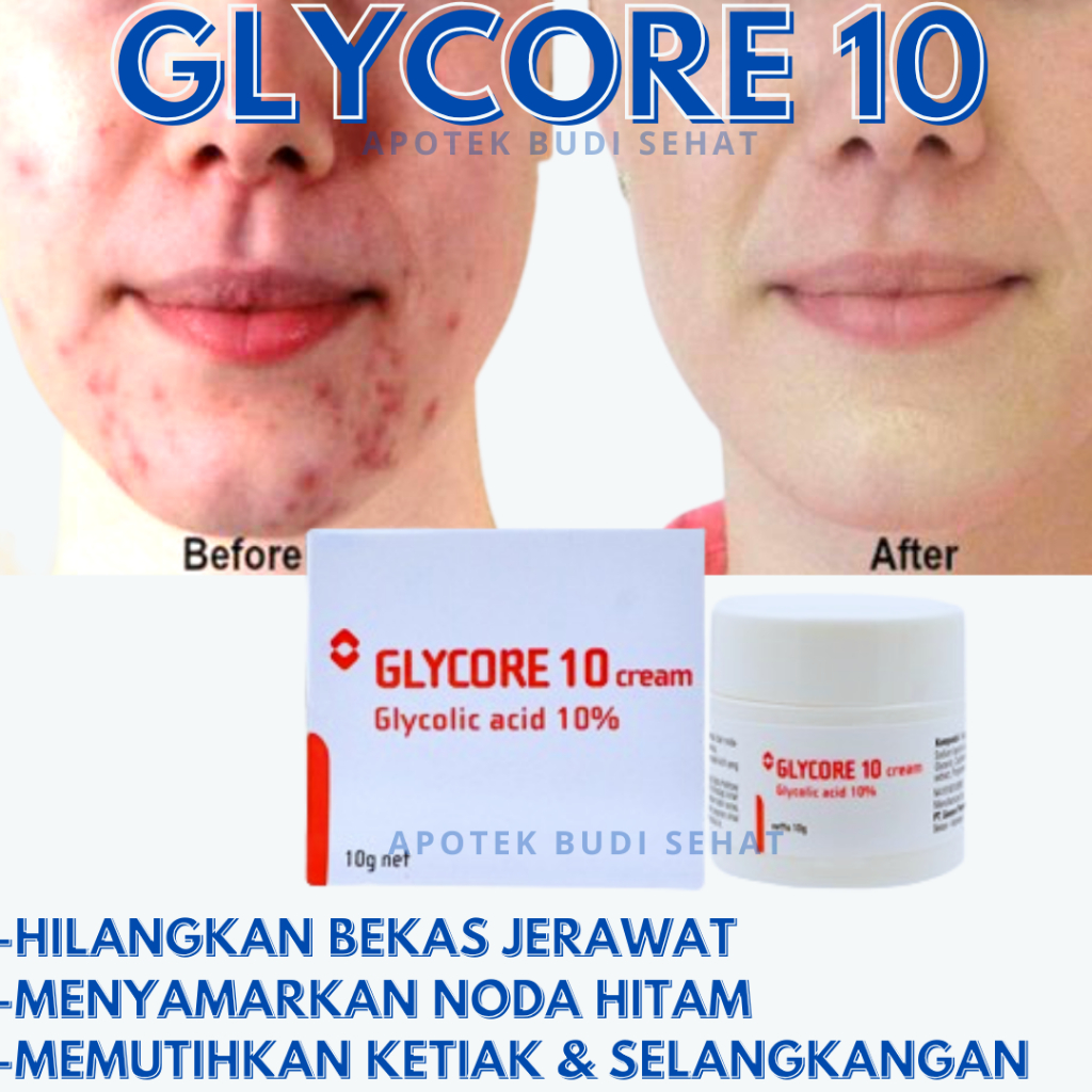 Jual GLYCORE 10 GLYCOLIC ACID KRIM 10 GR Bekas Jerawat Ketiak Hitam ...