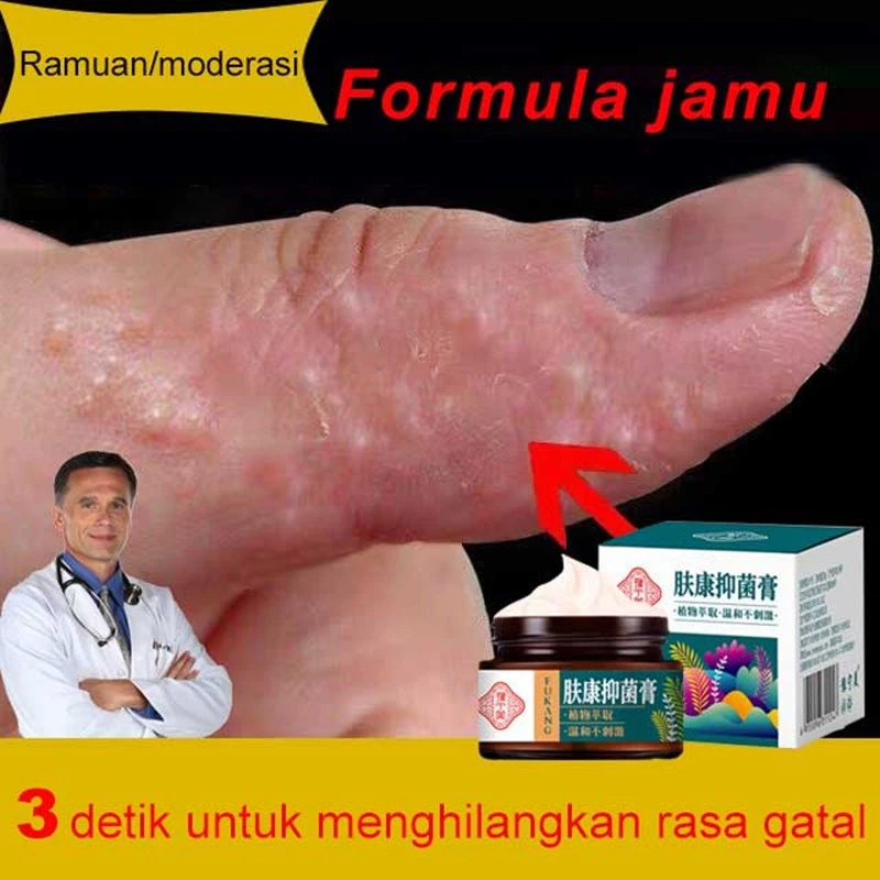 Jual 【100% Original】Obat Gatal Salep gatal paling ampuh Salep eksim ...