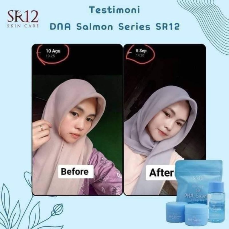 Jual dna salmon sr12|dna salmon menghilangkan bekas jerawat | Shopee Indonesia