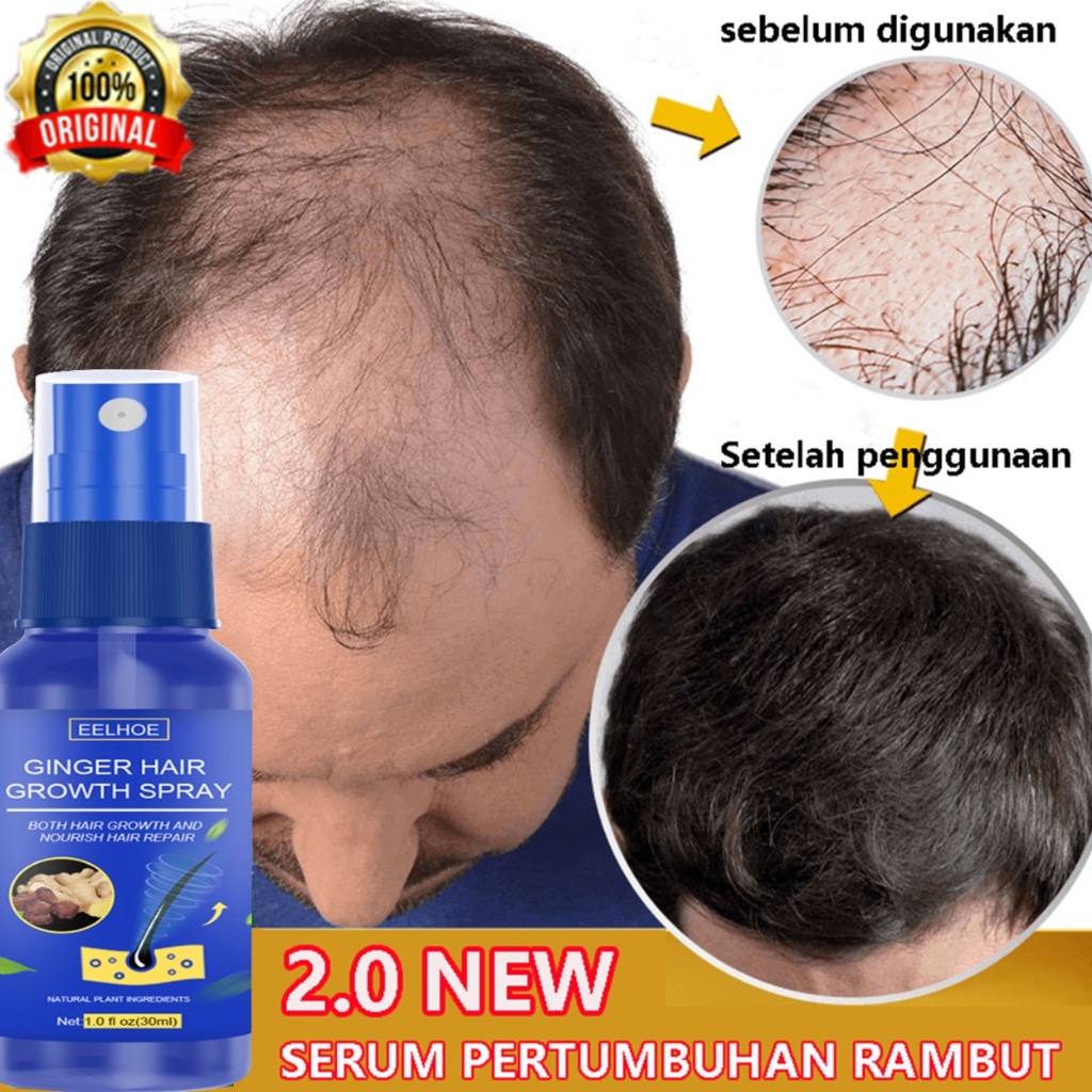 Jual serum penumbuh rambut botak serum rambut rontok rusak 100ml minyak ...