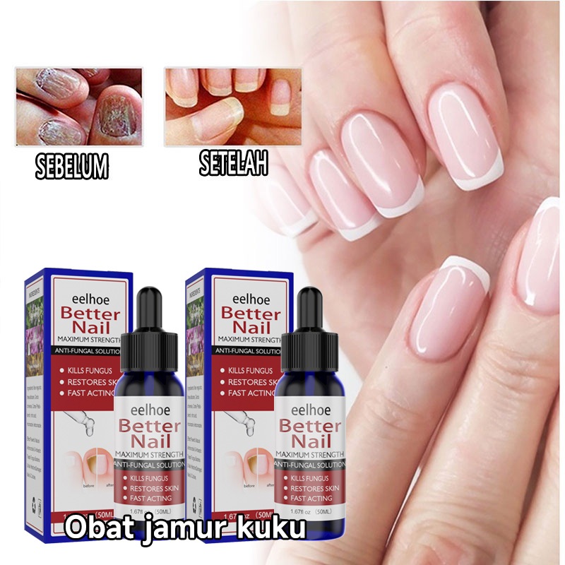 Jual 50ml Serum kuku jamur dan rusak Nail Repair Essence Serum ...