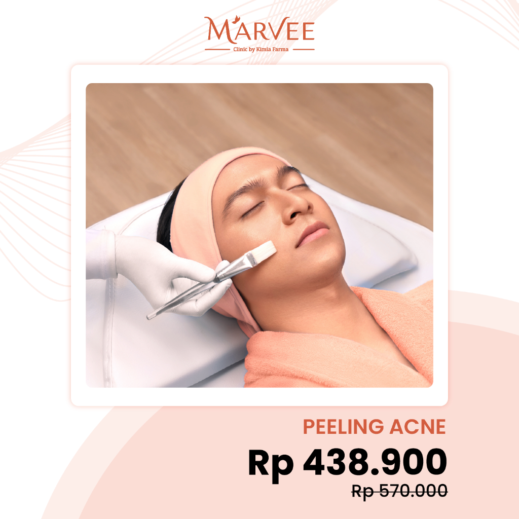 Jual PEELING ACNE TREATMENT - VOUCHER TREATMENT MARVEE CLINIC BY KIMIA ...