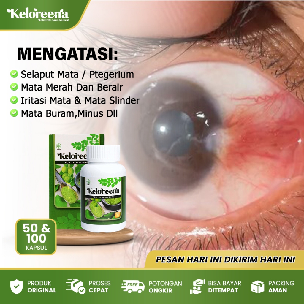 Jual Obat Mata Berlemak / Ptegerium, Vitamin Mata, Penyakit Glukoma ...