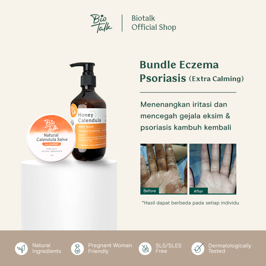 Jual Biotalk Bundle Eczema Psoriasis - Extra Calming | No SLS/SLES | Steroid Free | Sabun Mandi ...