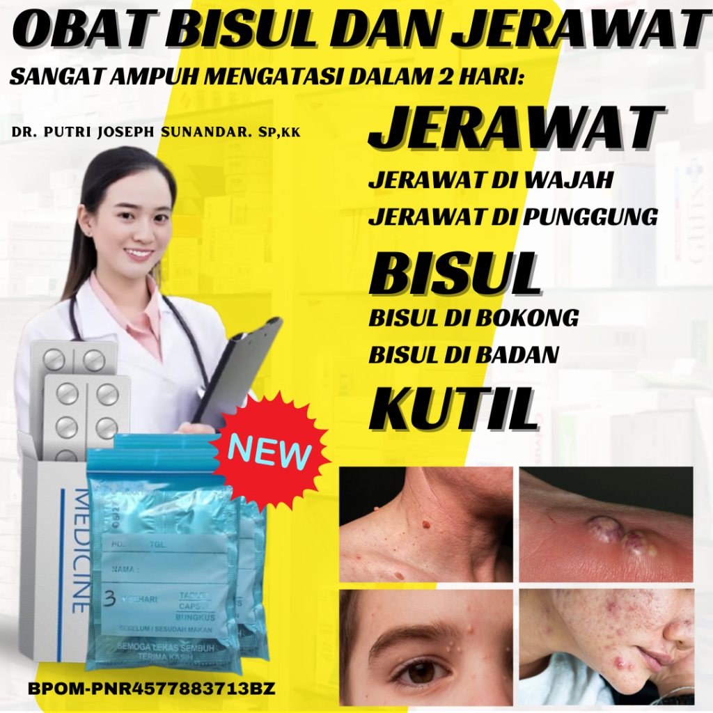 Jual OBAT BISUL AMPUH UNTUK MENGATASI BISUL , KUTIL, BENJOLAN BERNANAH | Shopee Indonesia