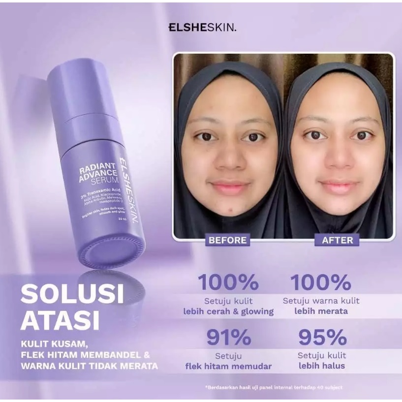 Jual New Formula Elsheskin Radiant Advance Serum 20ml - Brightening ...