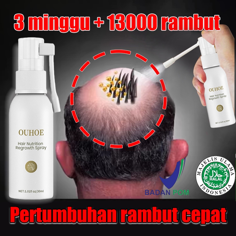 Jual Obat penumbuh rambut Serum penumbuh rambut botak Penumbuh rambut ...