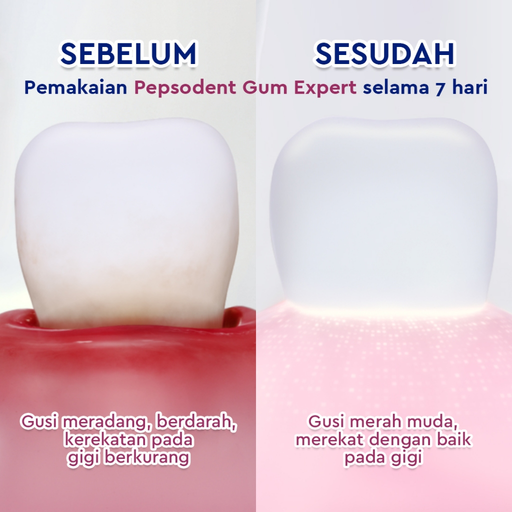 Jual Pepsodent Toothpaste Pasta Gigi Gum Expert Whitening Jaga Gusi ...