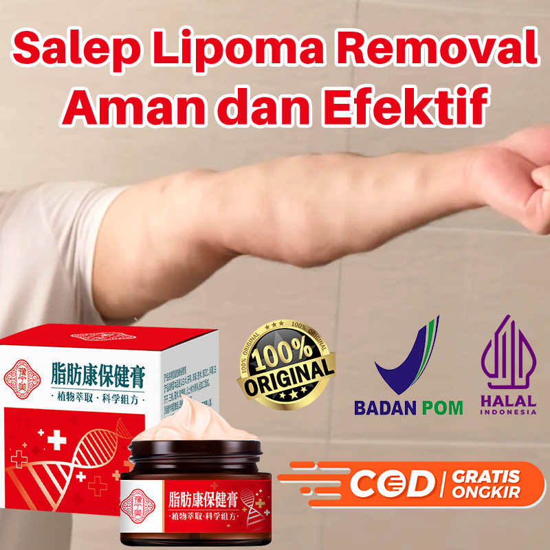 Jual Lipoma Cream Salep Lipoma Salep Benjolan 30g Obat Lipoma Obat ...