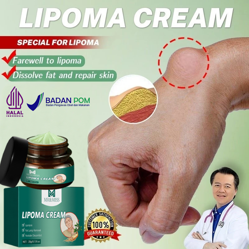 Jual Lipoma cream original Salep benjolan Obat benjolan 30g salep ...