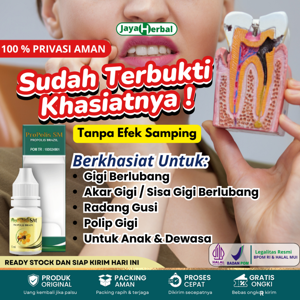 Jual Obat Sakit Gigi Berlubang Akar Gigi Berlubang Sakit Gigi Agar Cepat Sembuh Penghilang Sisa ...