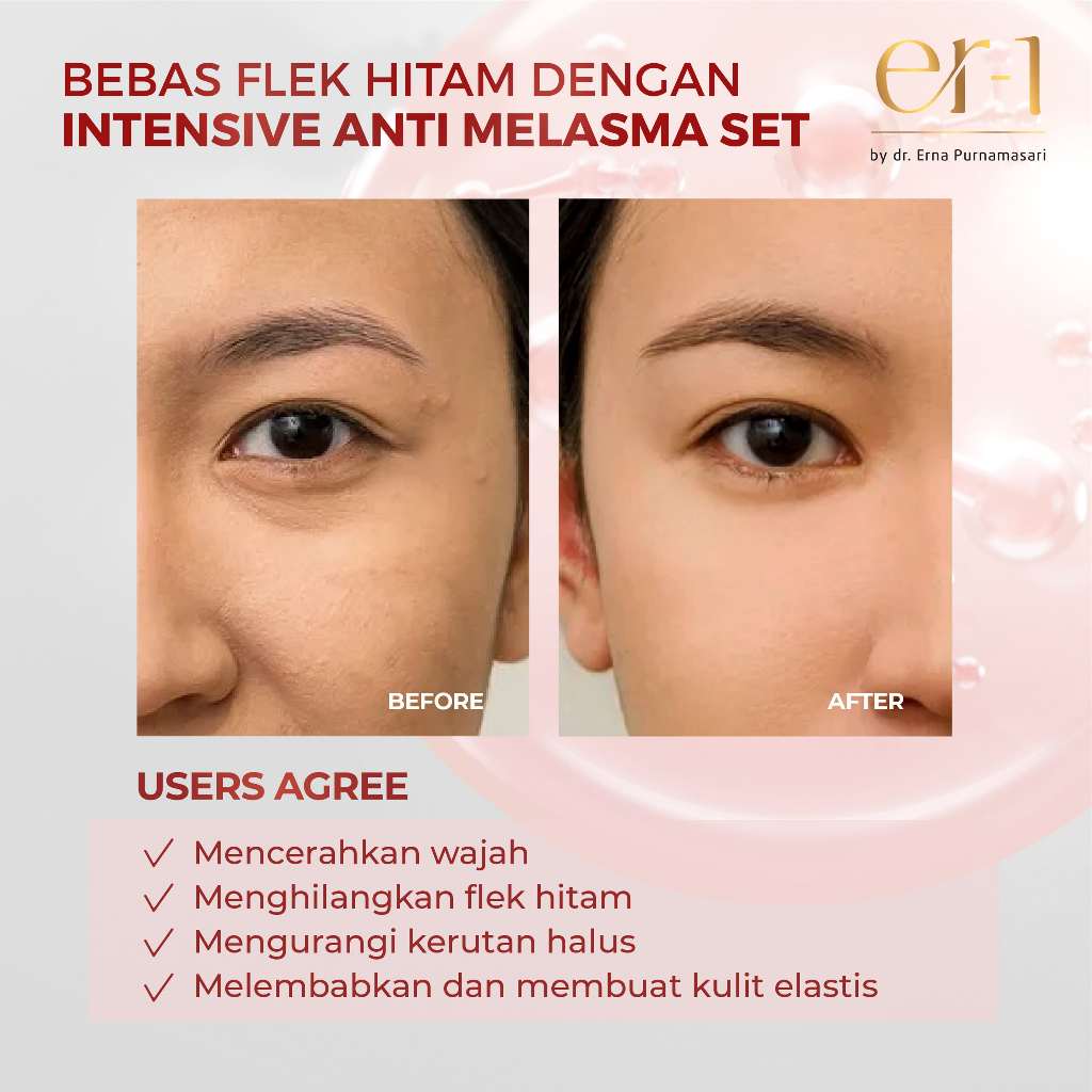 Jual er-1 by dr. Erna Intensive Anti Melasma Set 5 Pcs - Paket Skincare ...
