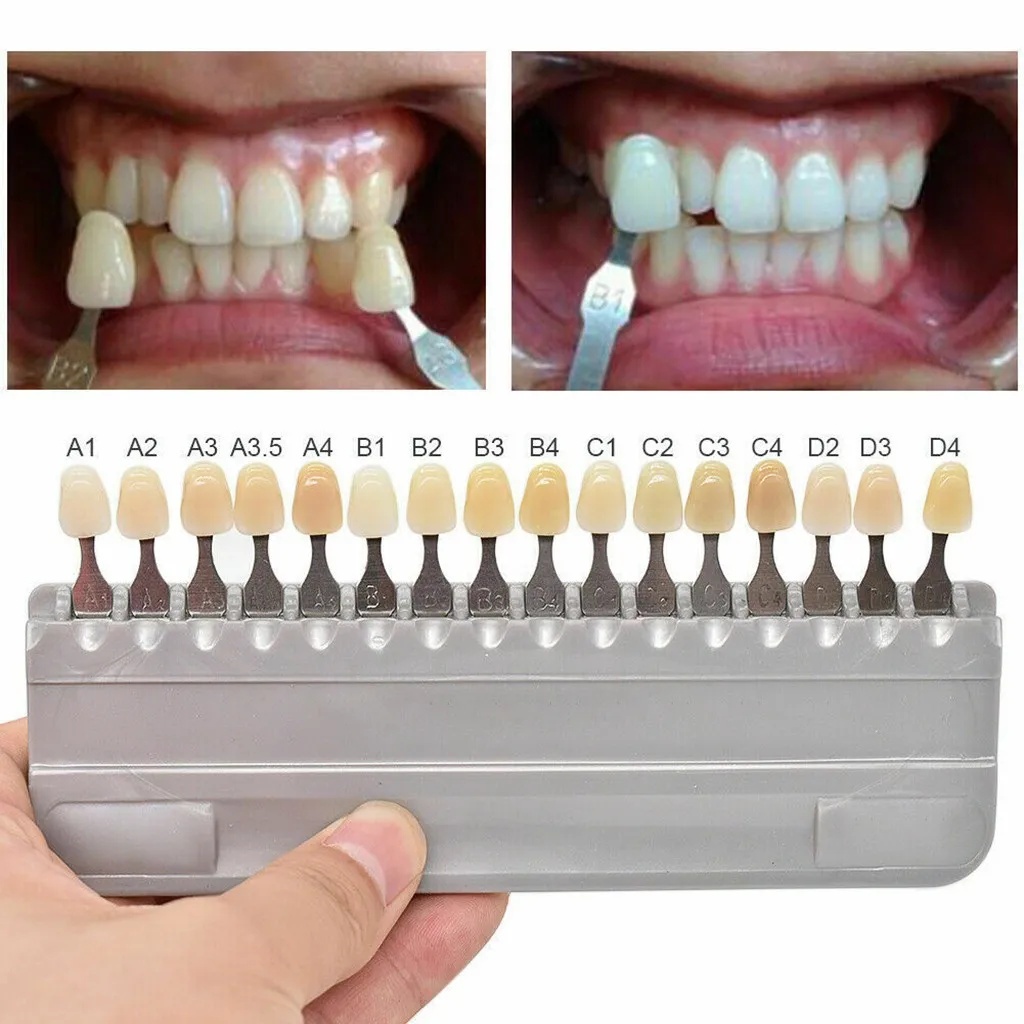 Jual VITA 16 Colors Teeth Shade Guide Classical Dentistry Tooth ...